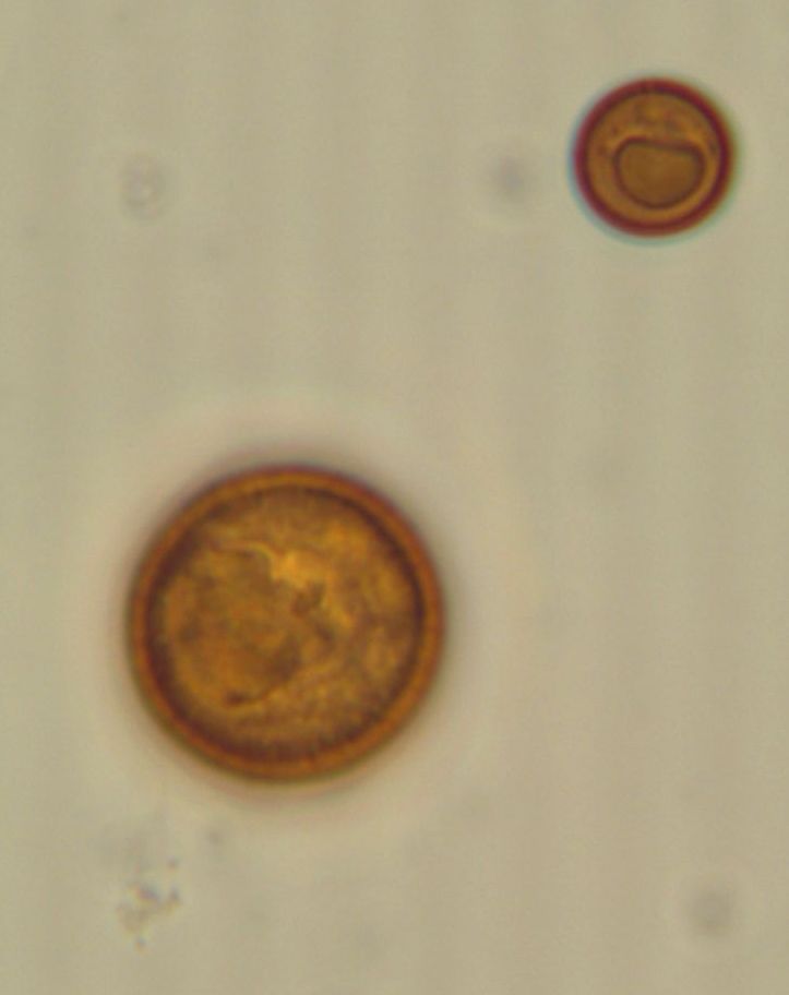 Chrysococcus sp & Trachelomonas sp 7,3 & 14 Kotojärvi, Päivin näyte 31 ...